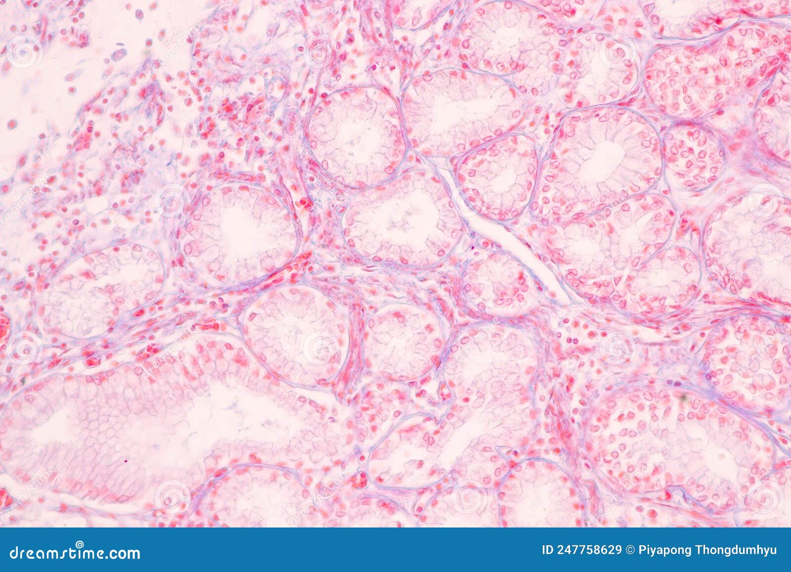 Tissue of Stomach Human Under the Microscope in Lab. Stock Image ...