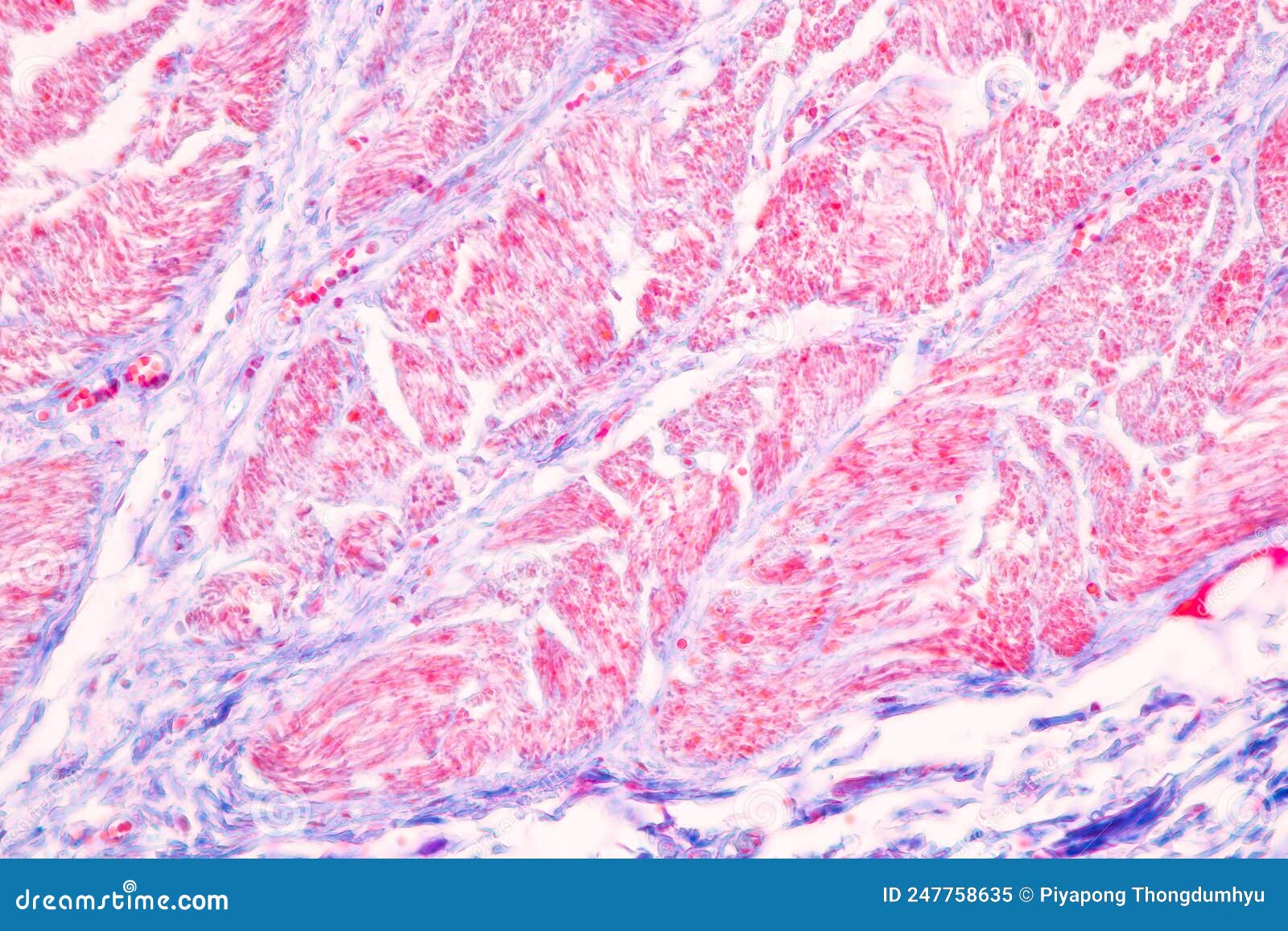 Tissue of Stomach Human Under the Microscope in Lab. Stock Image ...