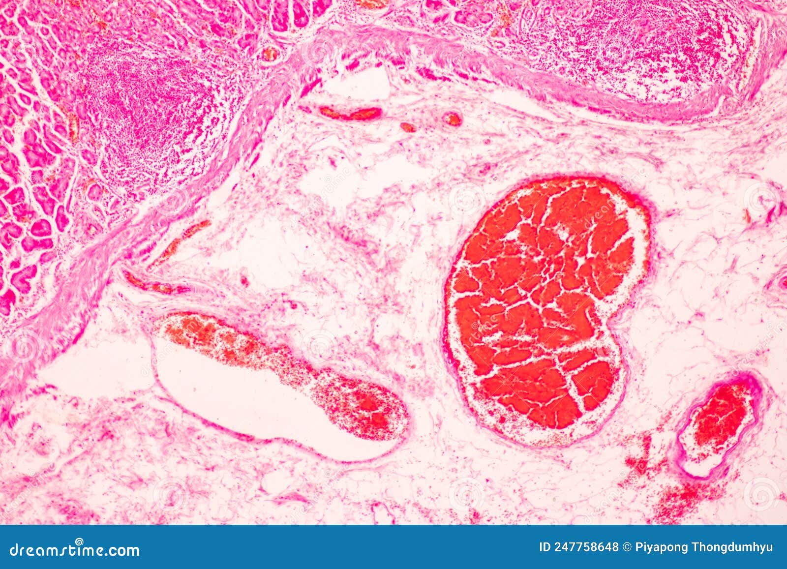 Tissue of Stomach Human Under the Microscope in Lab. Stock Photo ...