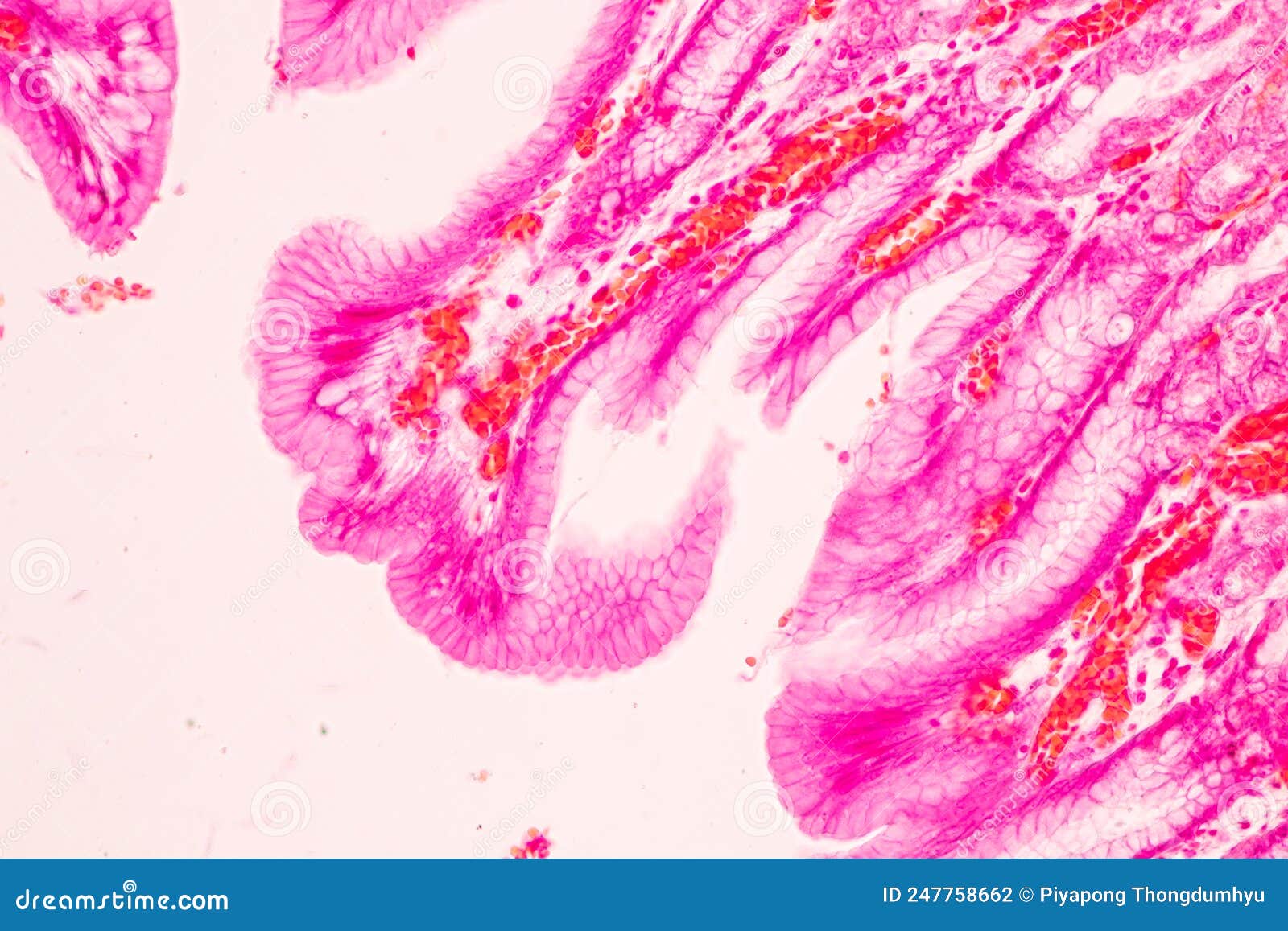 Tissue of Stomach Human Under the Microscope in Lab. Stock Photo ...