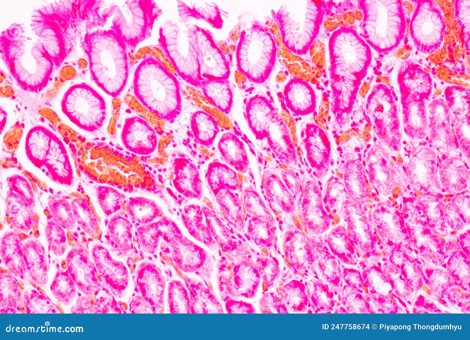 Tissue of Stomach Human Under the Microscope in Lab. Stock Photo ...