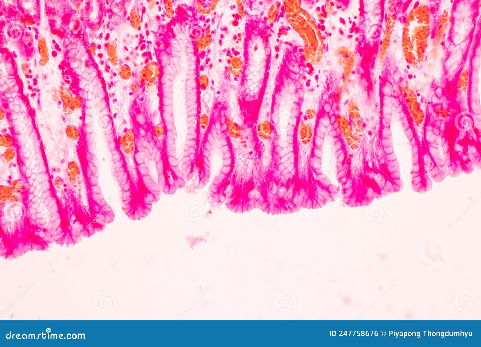 Tissue of Stomach Human Under the Microscope in Lab. Stock Photo ...