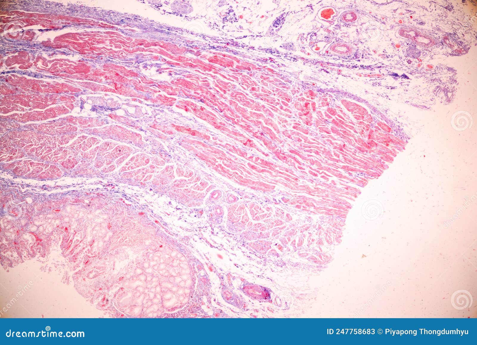 Tissue of Stomach Human Under the Microscope in Lab. Stock Image ...