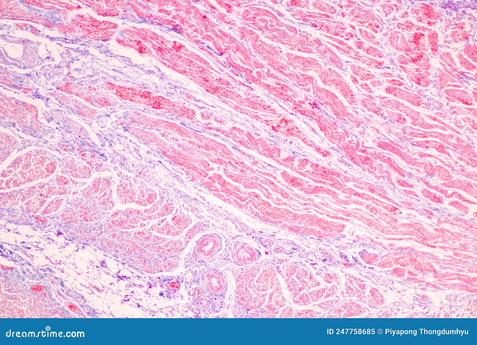 Tissue of Stomach Human Under the Microscope in Lab. Stock Image ...