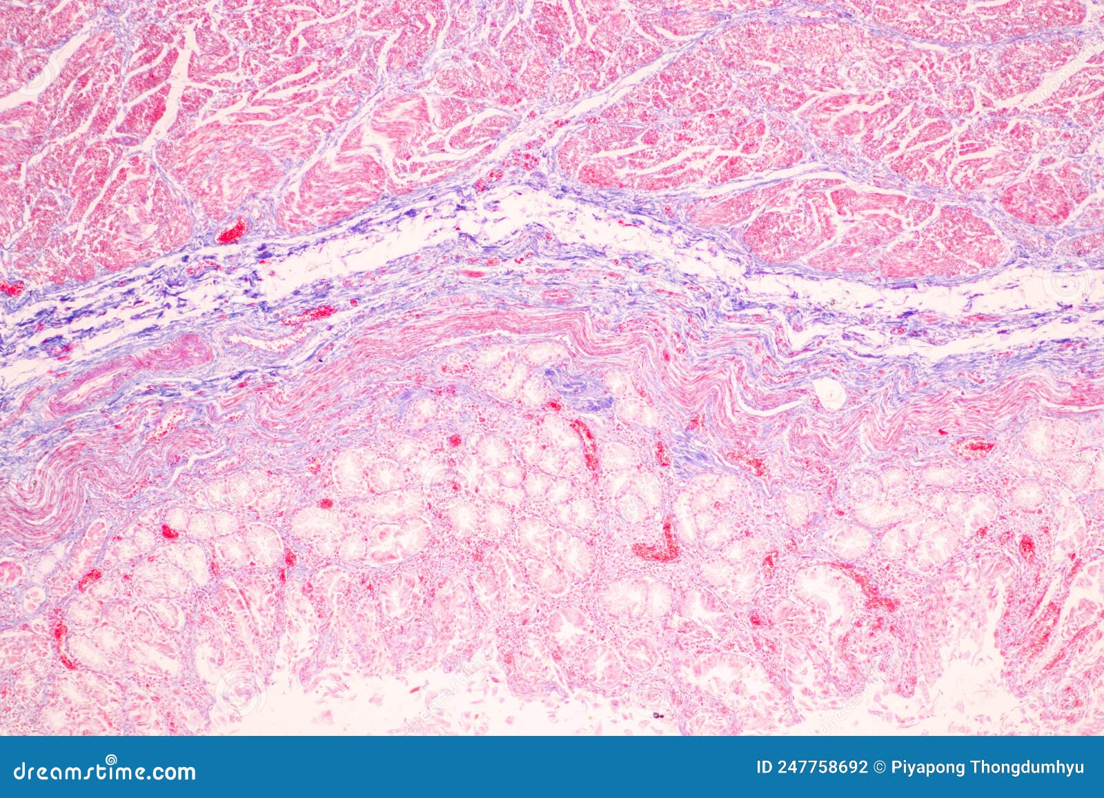 Tissue of Stomach Human Under the Microscope in Lab. Stock Photo ...