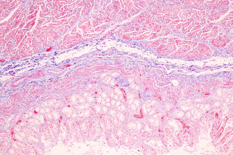 Tissue of Stomach Human Under the Microscope in Lab. Stock Photo ...