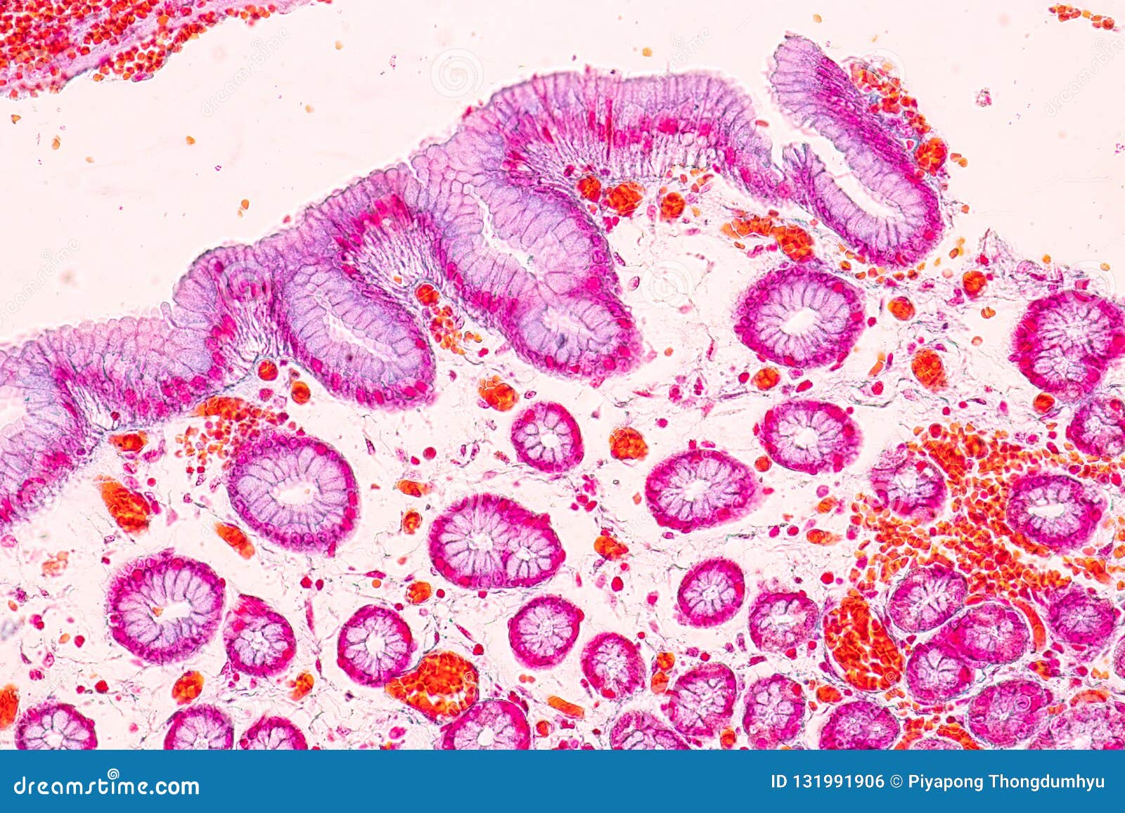 Tissue of Stomach Under the Microscope for Education. Stock Photo ...
