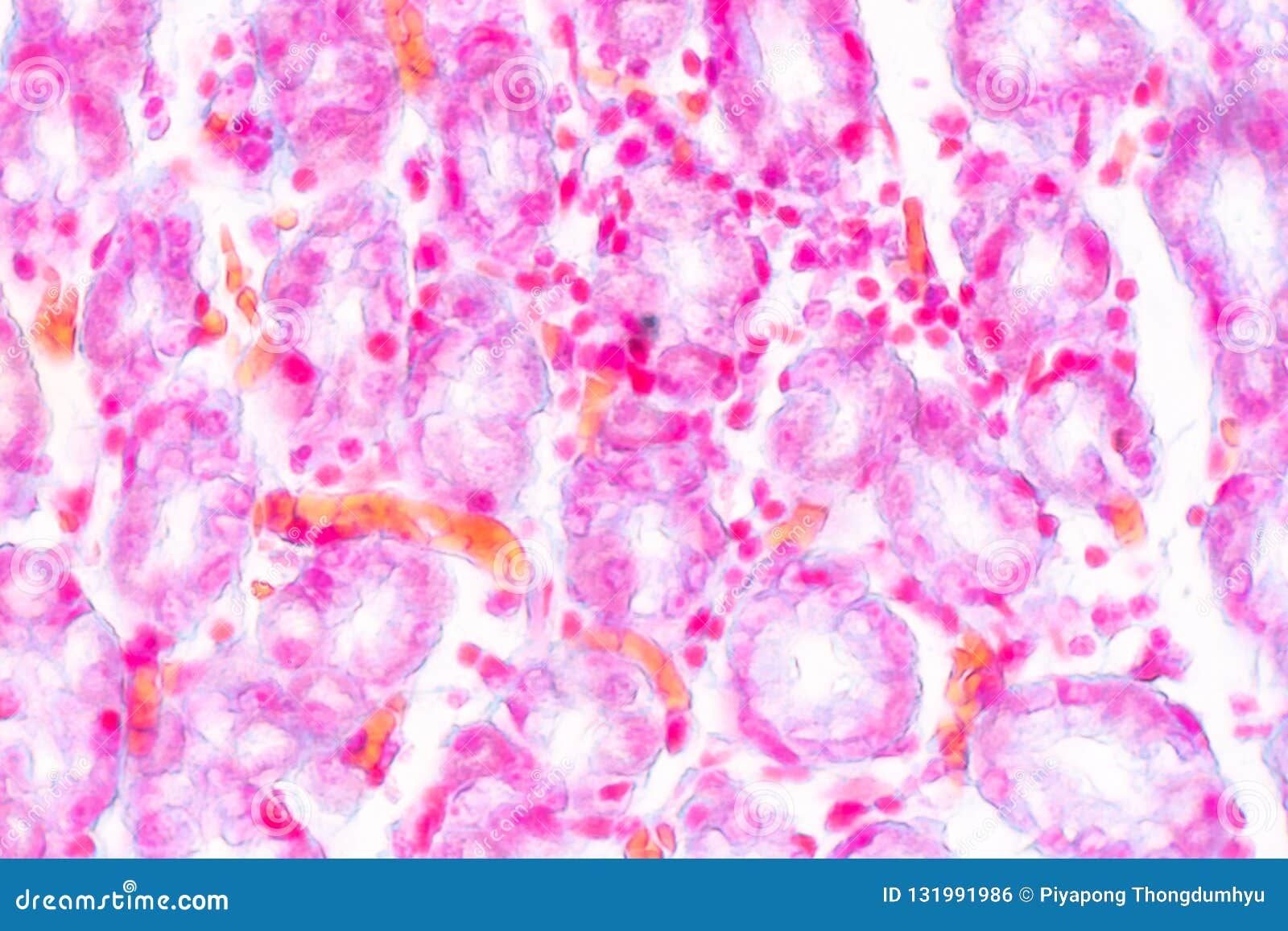 Tissue of Stomach Under the Microscope for Education. Stock Photo ...