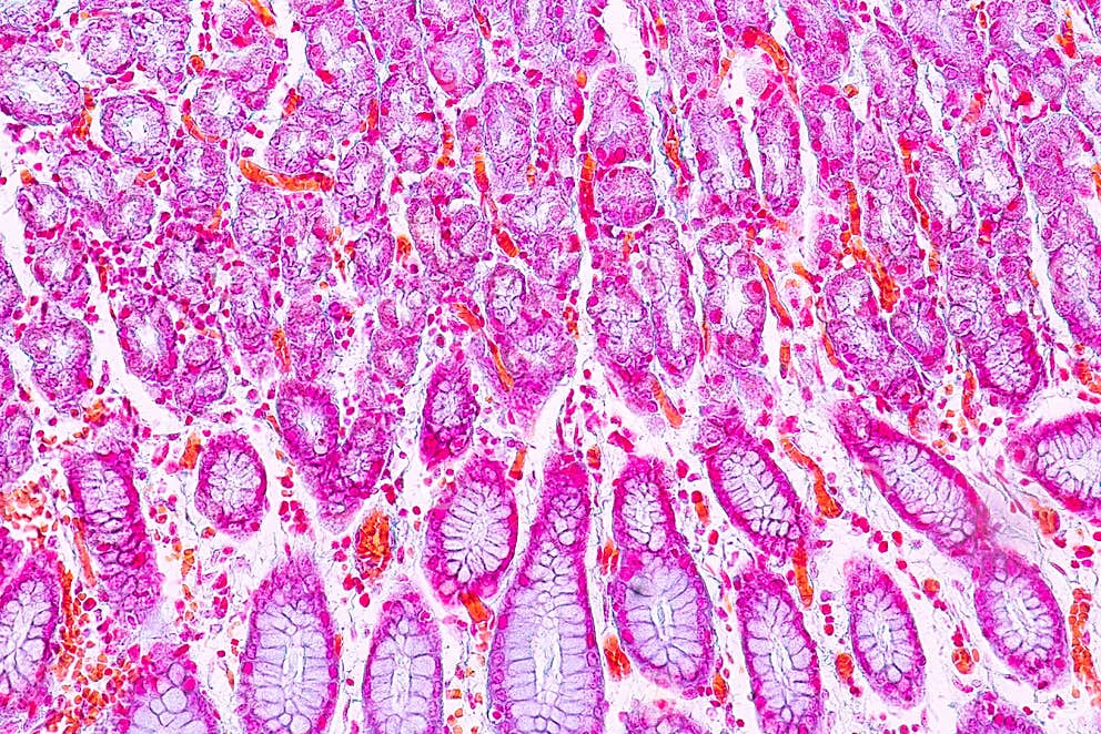 Tissue of Stomach Under the Microscope for Education. Stock Photo ...