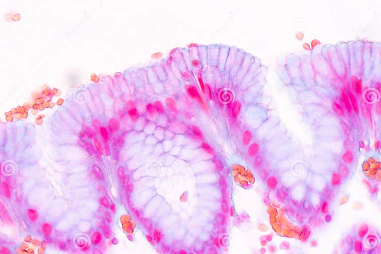 Tissue of Stomach Under the Microscope for Education. Stock Image ...