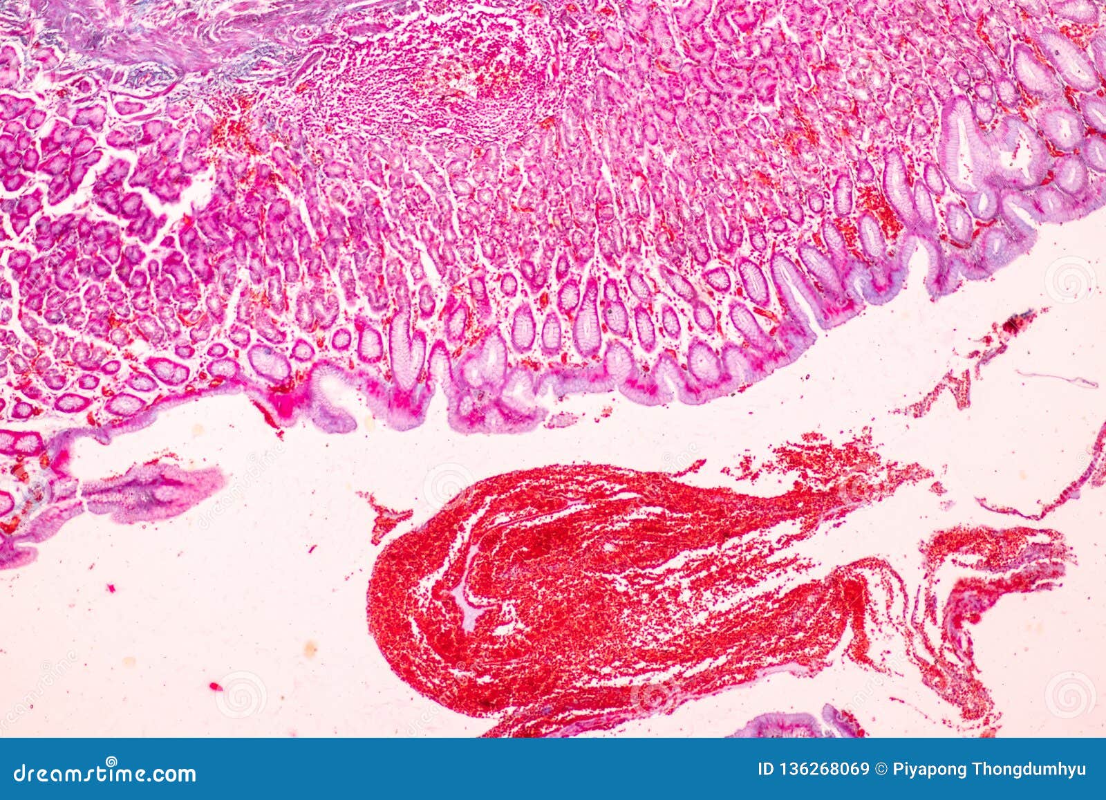 Tissue of Stomach Under the Microscopic, Physiology of the Stomach for ...