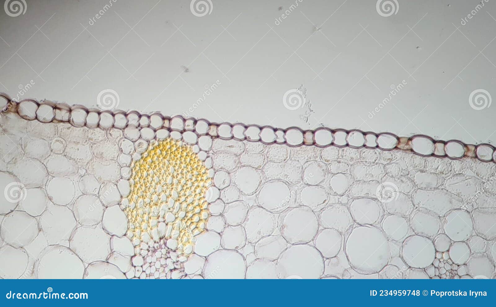Tissues Of Iris Root, Microscopical Structure Royalty-Free Stock Image ...