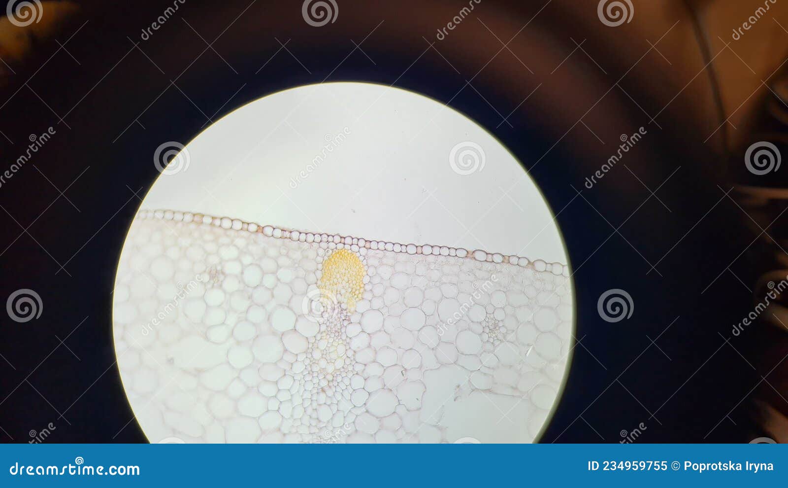 Tissues Of Iris Root, Microscopical Structure Royalty-Free Stock Image ...