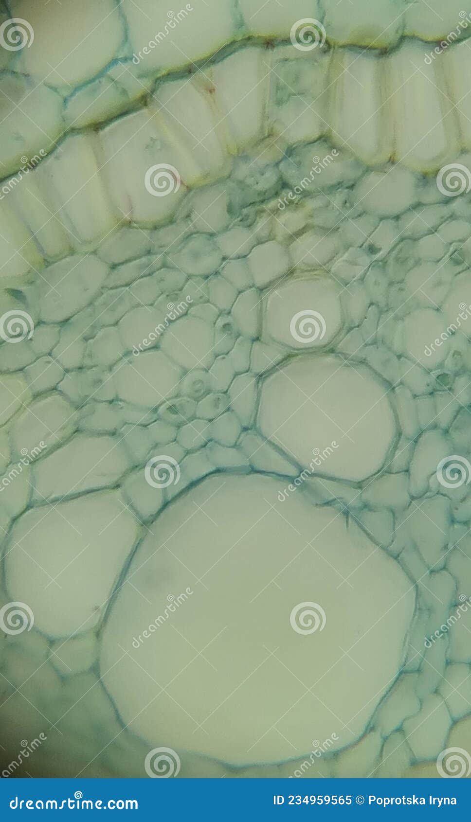 Tissues of Primary Structure of Iris Root Stock Image - Image of bundle ...