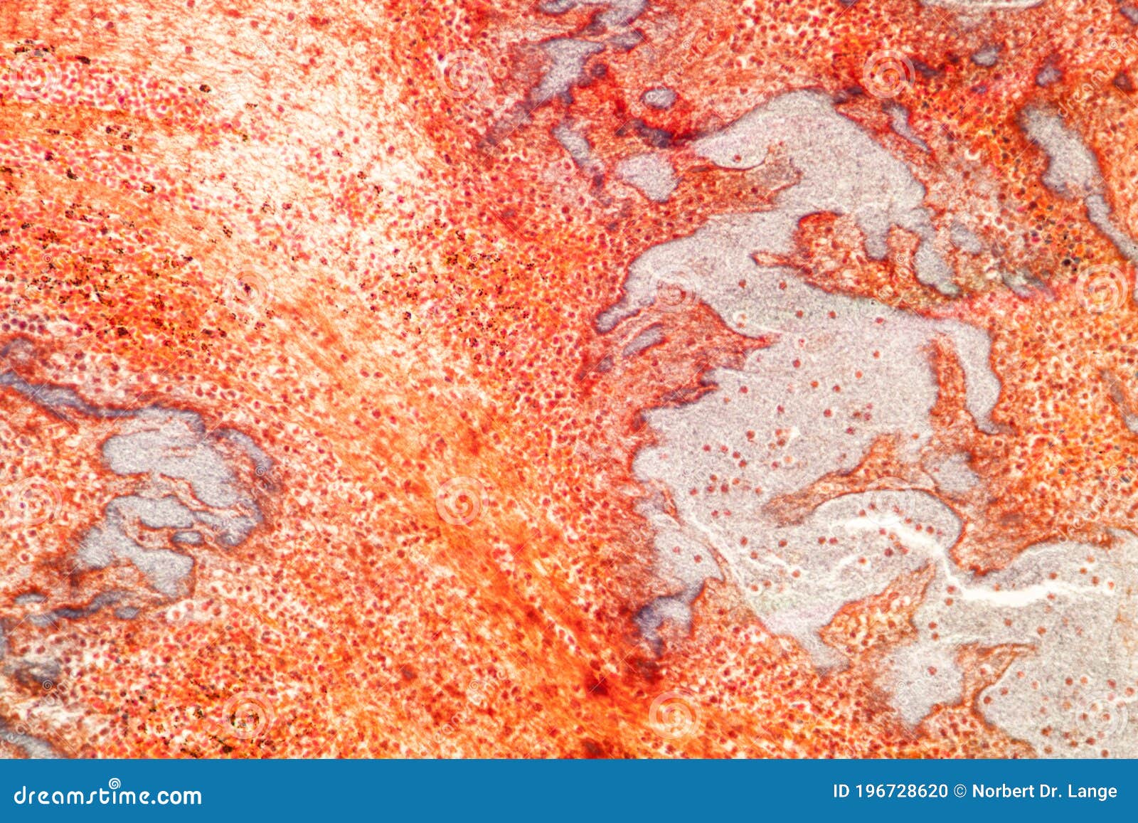 Tissus gras de coeur photo stock. Image du cellules - 196728620