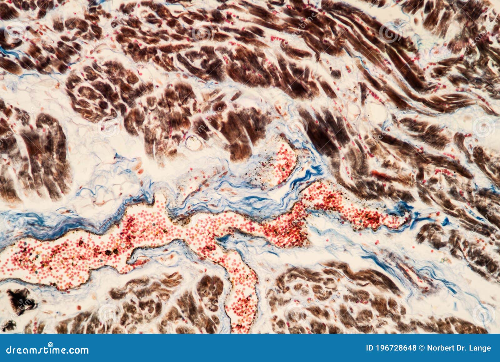 Tissus gras de coeur photo stock. Image du grossissement - 196728648