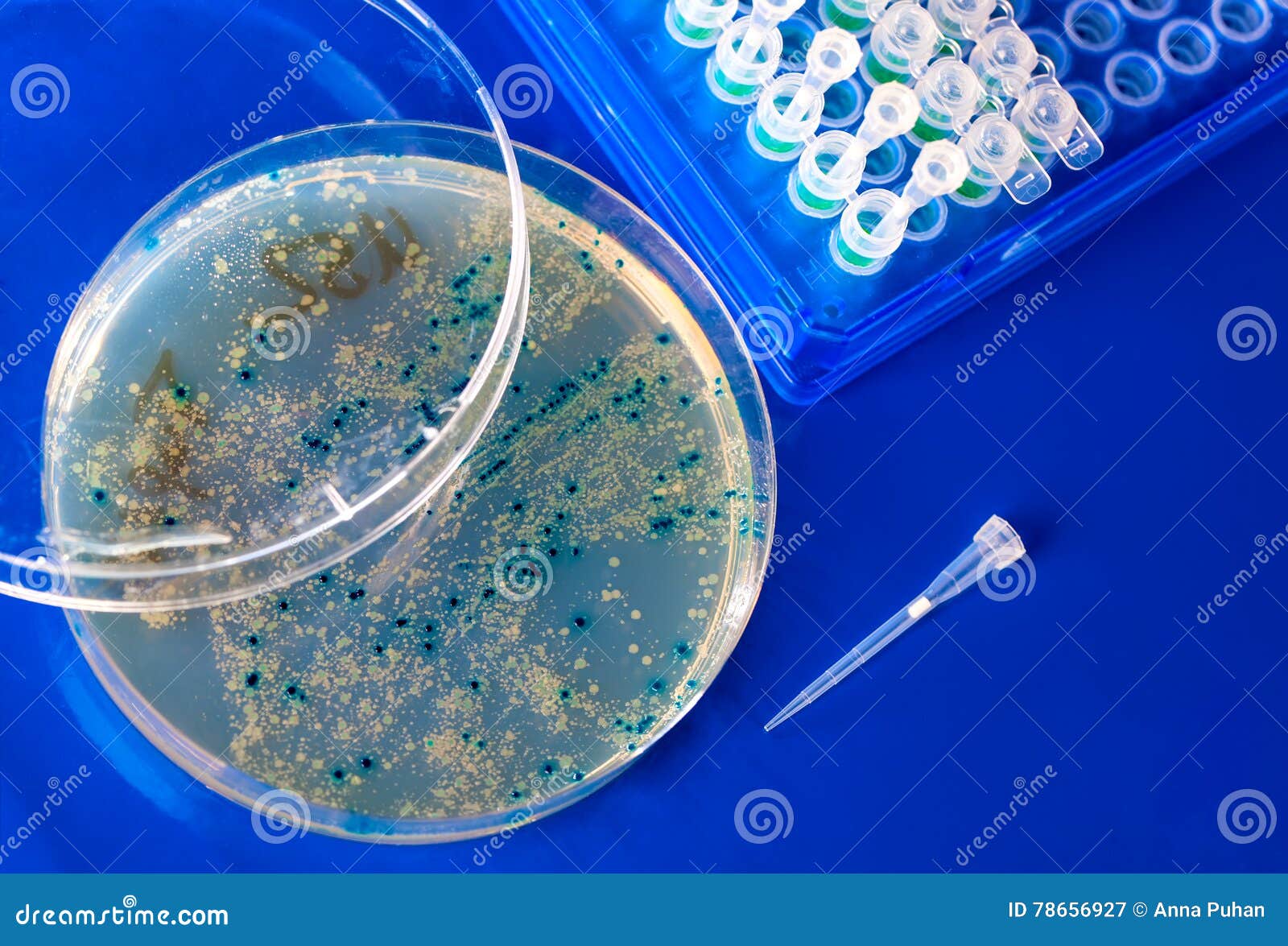 Titer test stock image. Image of bacteriophage, care - 78656927