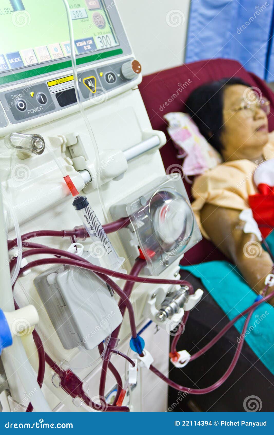 To Purify the Blood with Artificial Kidney Stock Photo - Image of donor ...