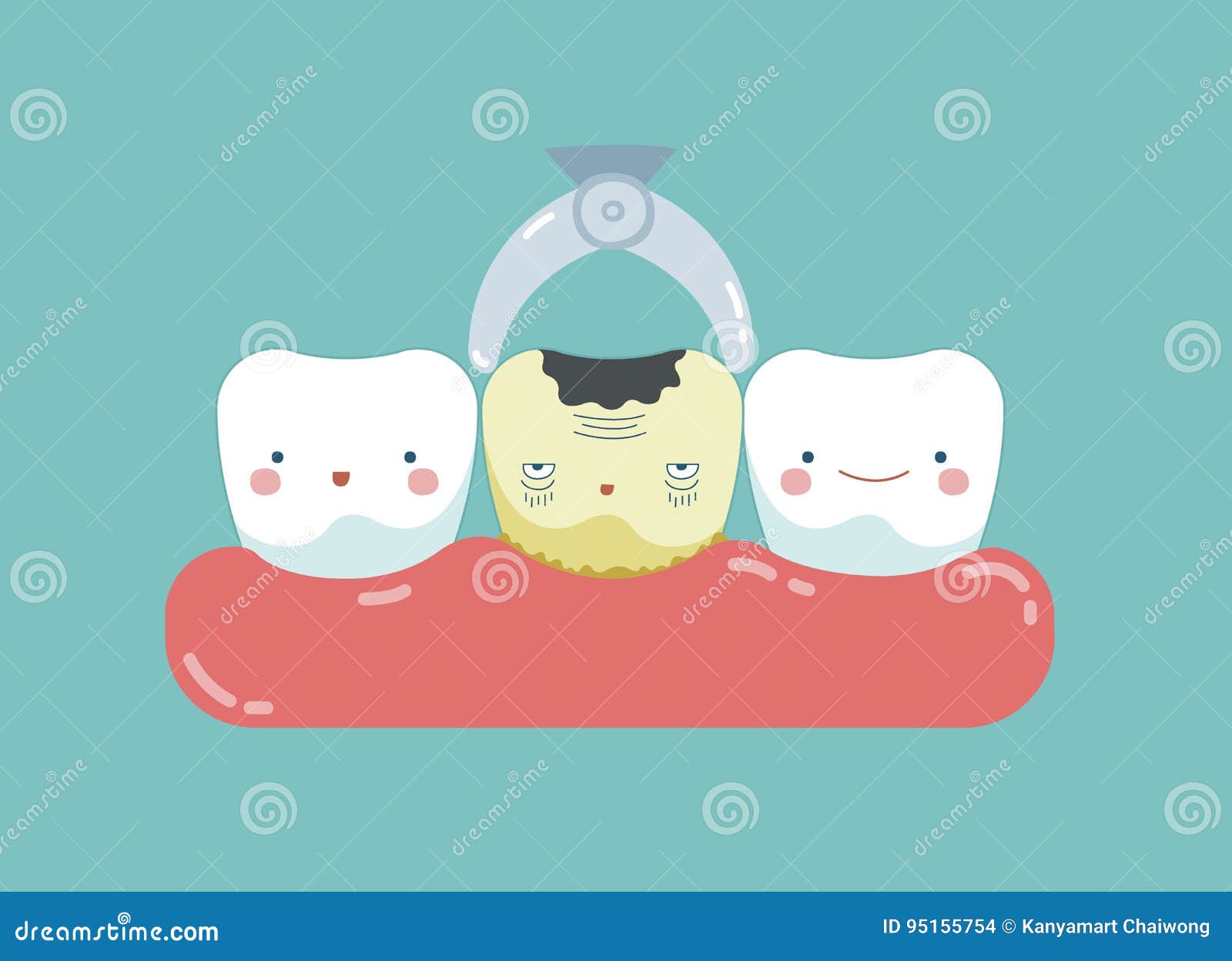 Decayed Tooth Poster Vector Illustration | CartoonDealer.com #227161192