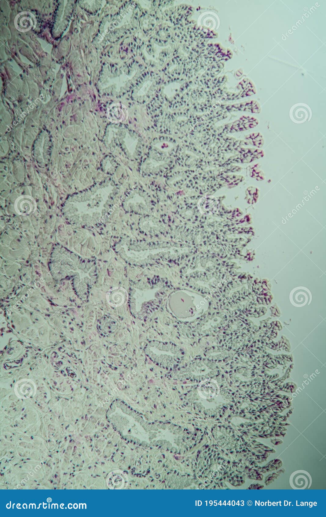 Toad Cross Section through the Tongue Stock Image - Image of excrement ...