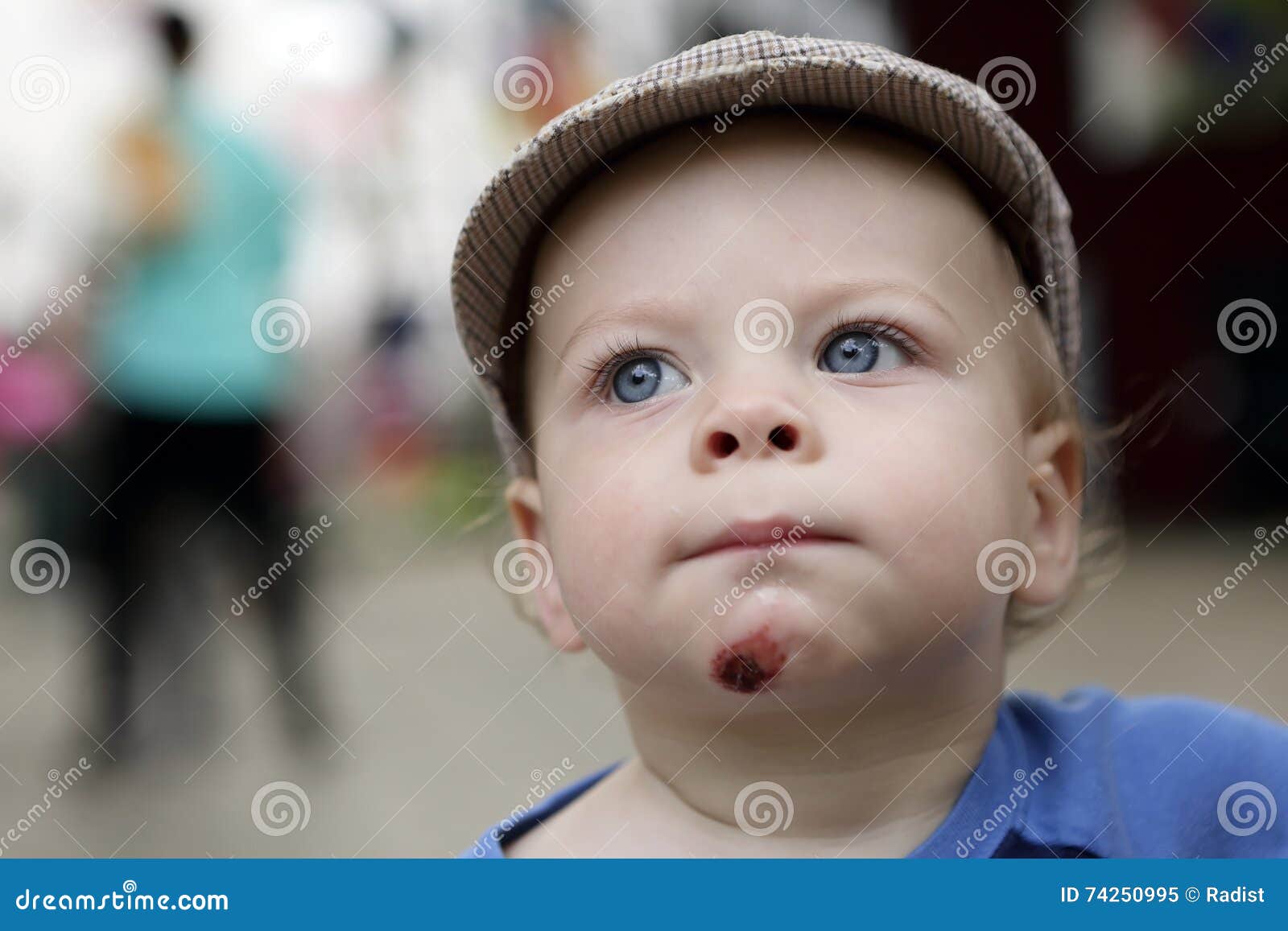 Toddler with a Wound on His Chin Stock Image - Image of patient, head ...