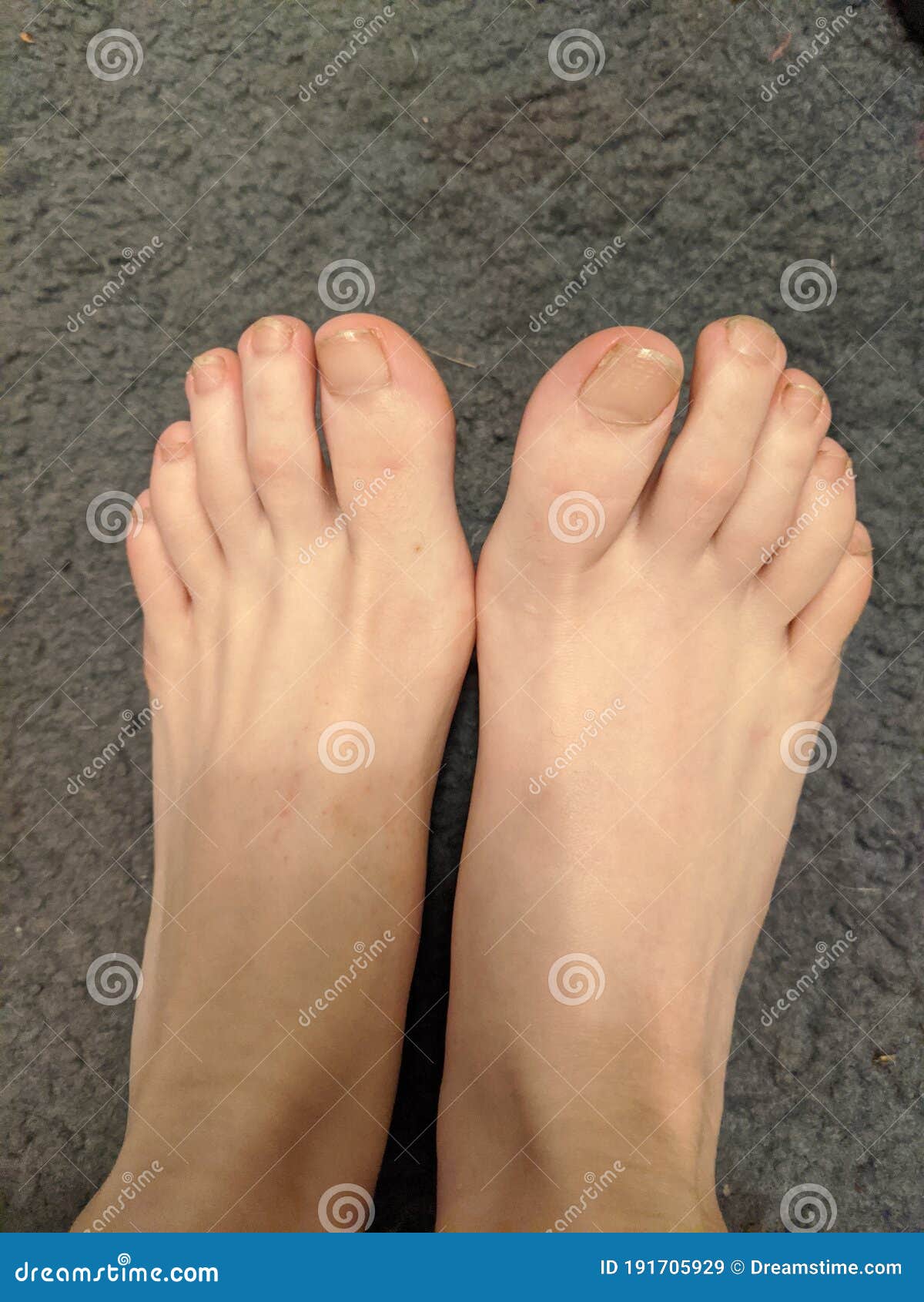 Toe beans stock image. Image of limb, footwear, hand - 191705929