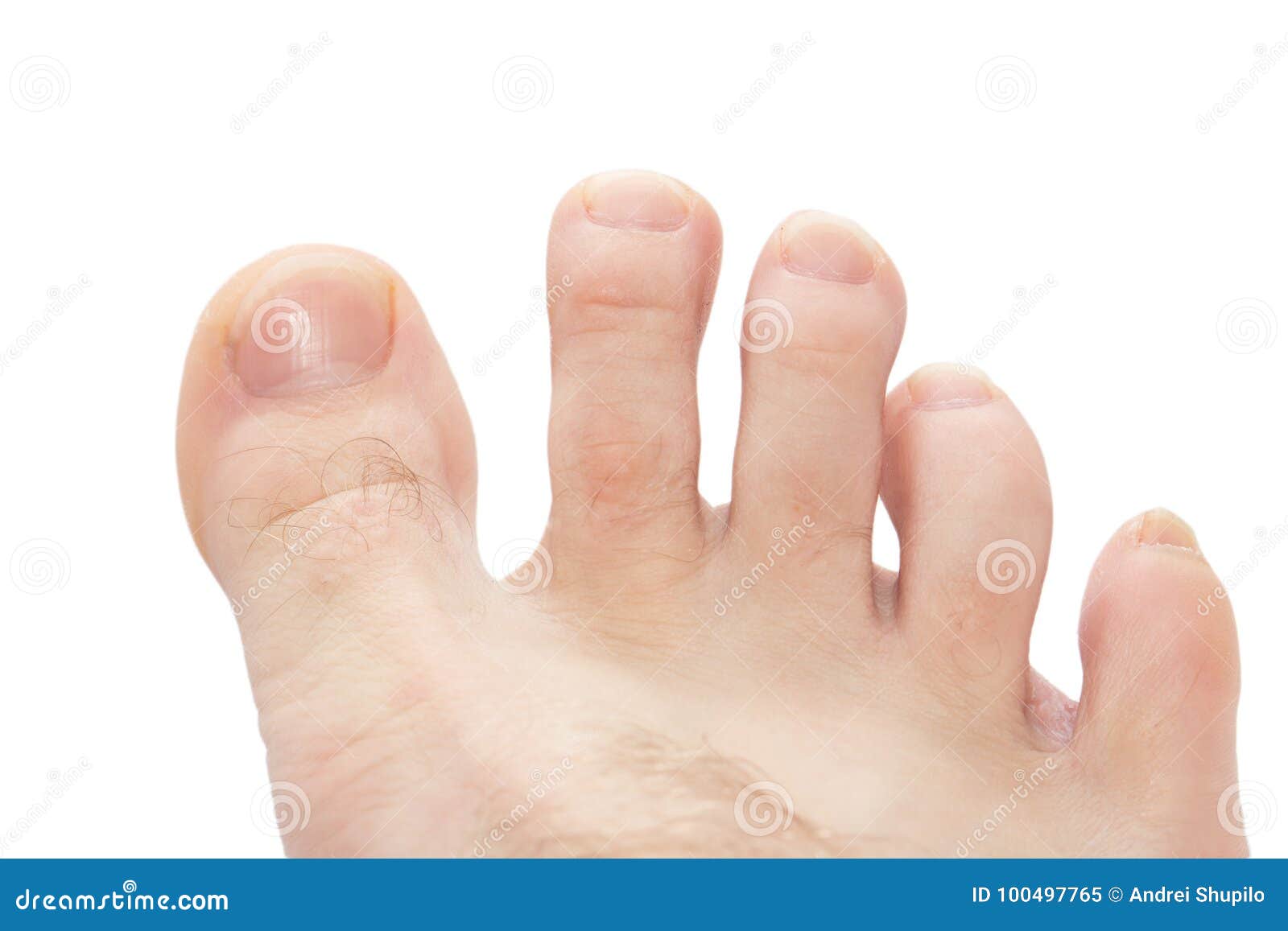 Toes on a White Background. Macro Stock Image - Image of closeup, white ...