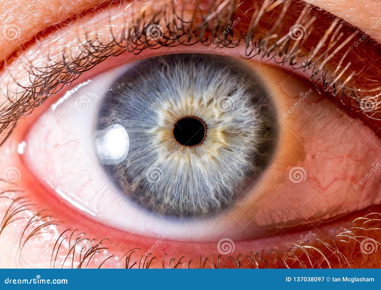 Close Up Eye. Close Up Iris. Very Close Macro Shot of an Eyeball. Blue ...