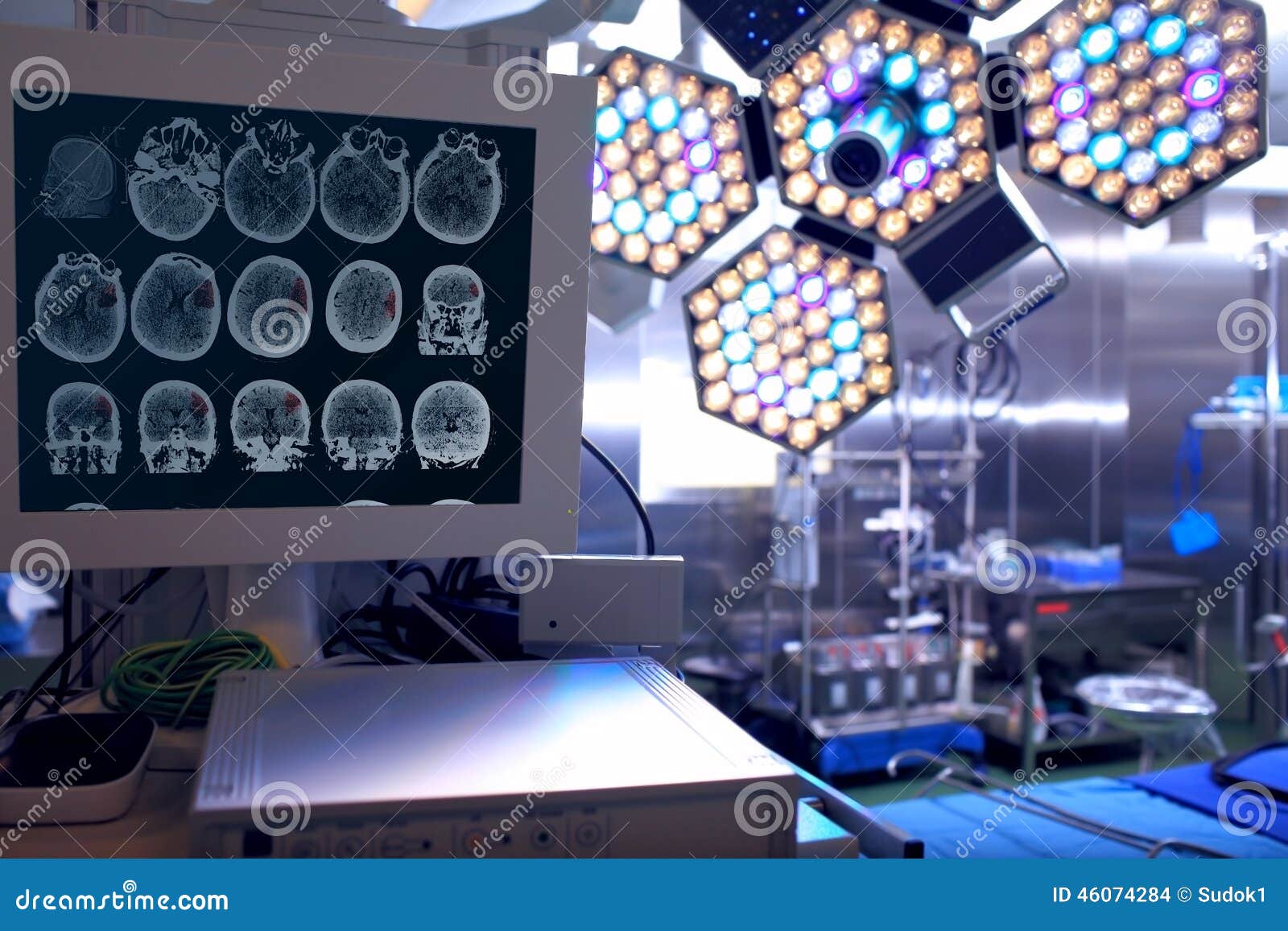 Tomogram in Neurosurgical Operating Room Stock Photo - Image of exam ...