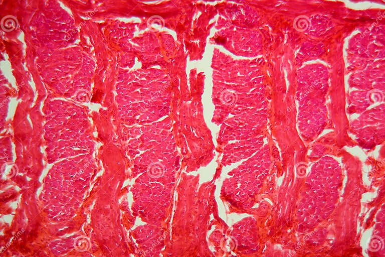 Tongue Cells Under the Microscope Stock Photo - Image of infection ...