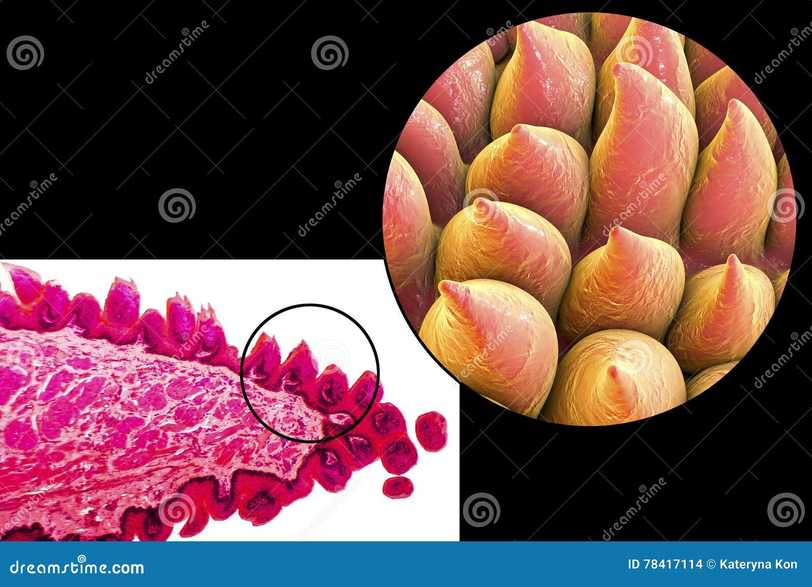 Tongue Papillae, Illustration Stock Illustration - Illustration of ...
