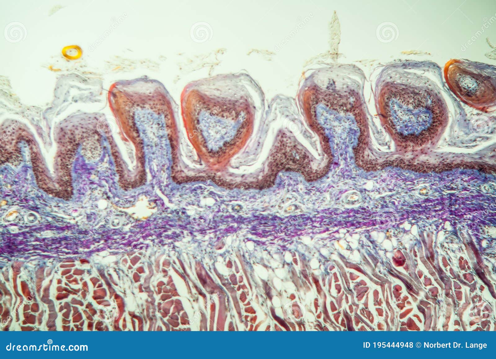 Tongue Tissue with Taste Buds Across Stock Photo - Image of ...