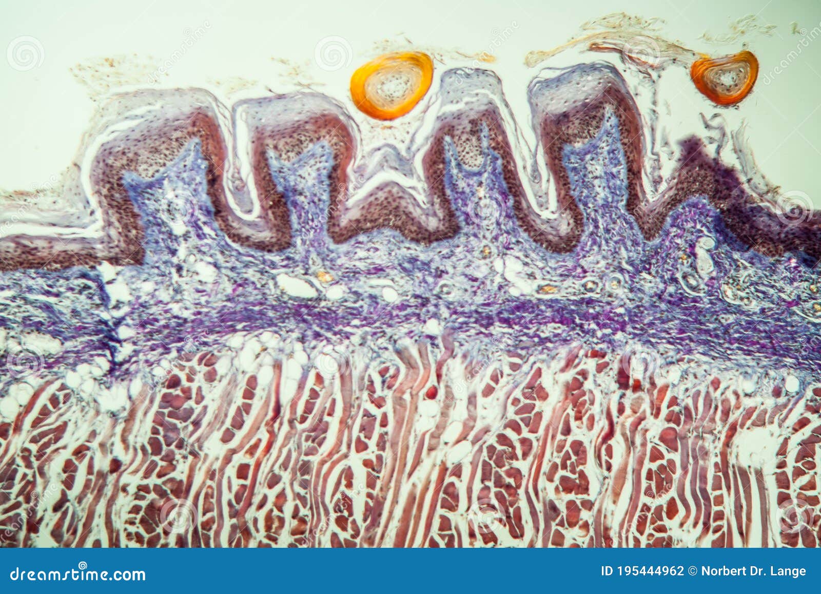 Tongue Tissue with Taste Buds Across Stock Photo - Image of histology ...