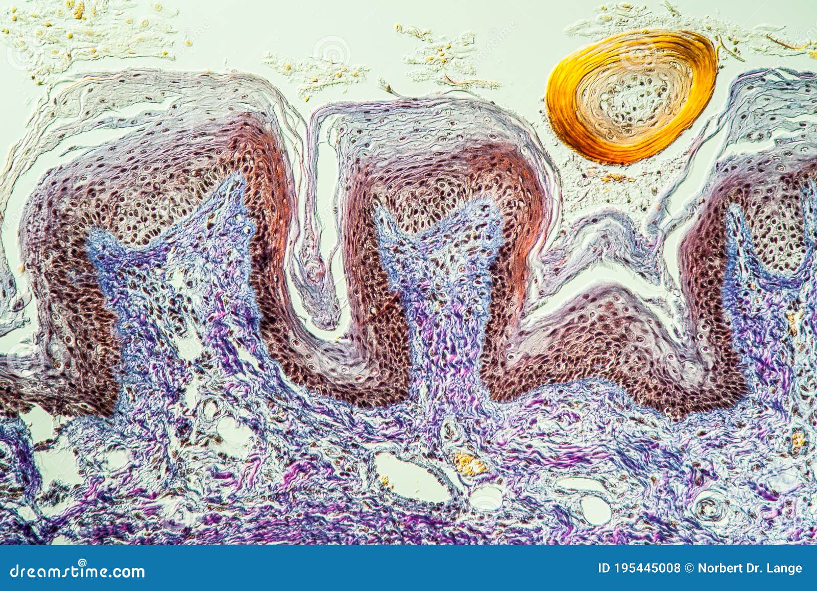 Tongue Tissue with Taste Buds Across Stock Photo - Image of macro, tiny ...