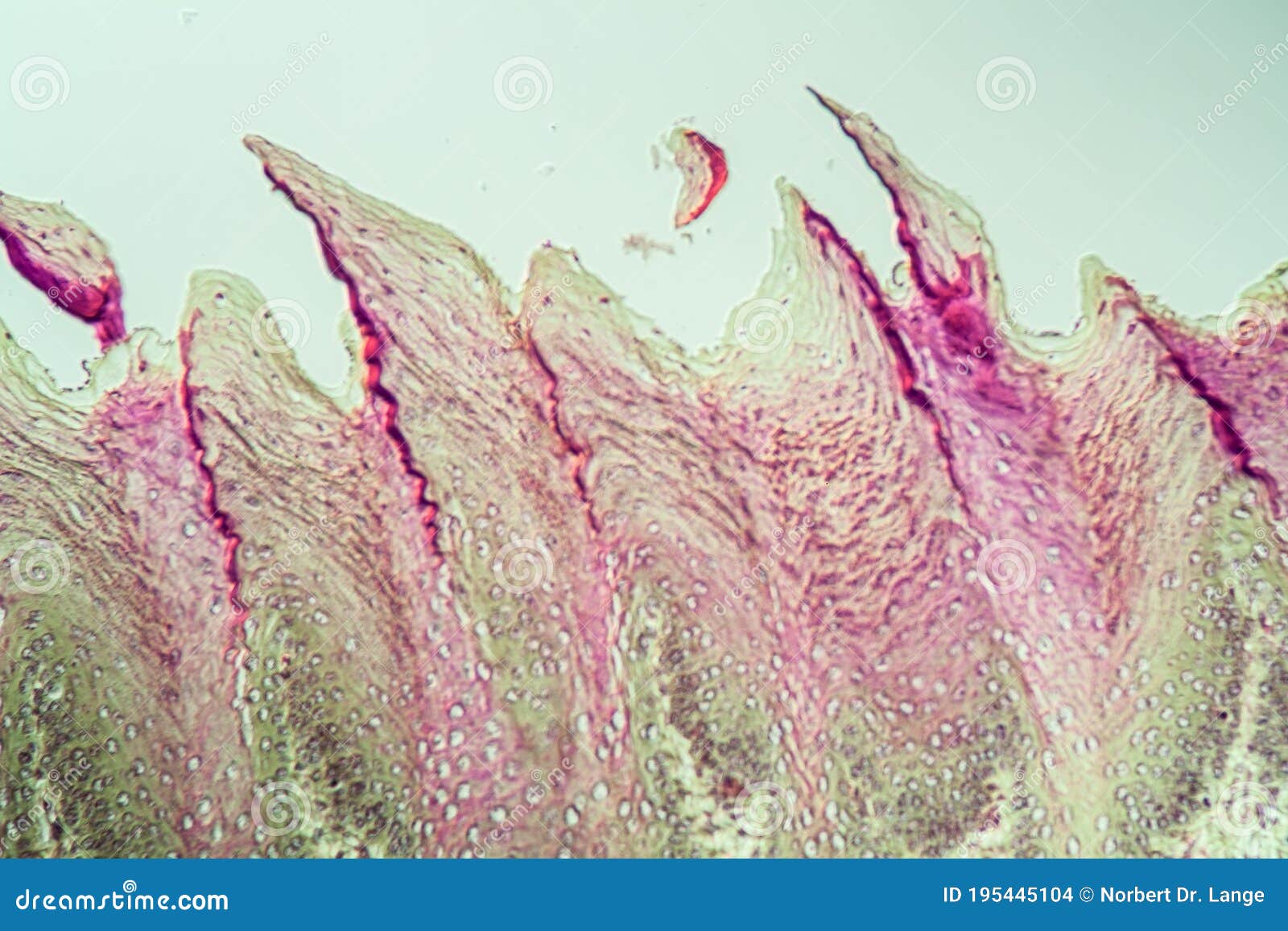 Tongue Tissue with Taste Buds Across Stock Photo - Image of medicine ...