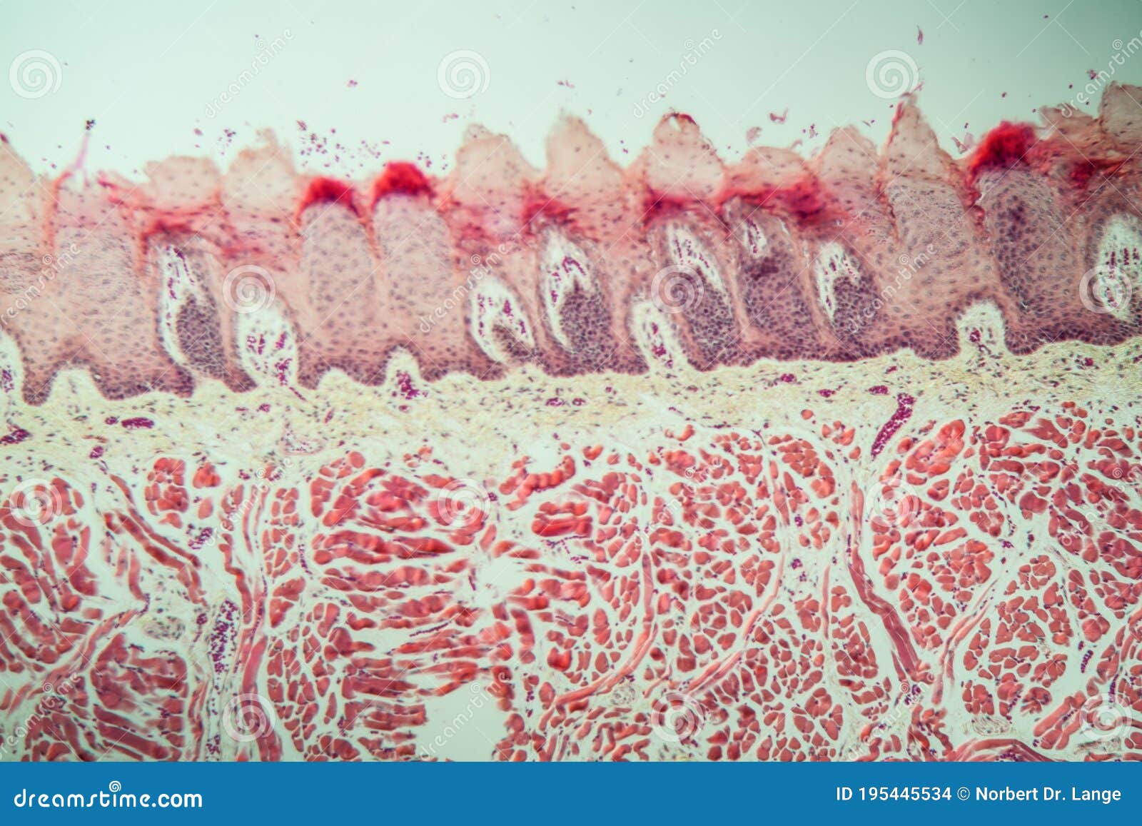 Tongue Tissue with Taste Buds Across Stock Photo - Image of ...