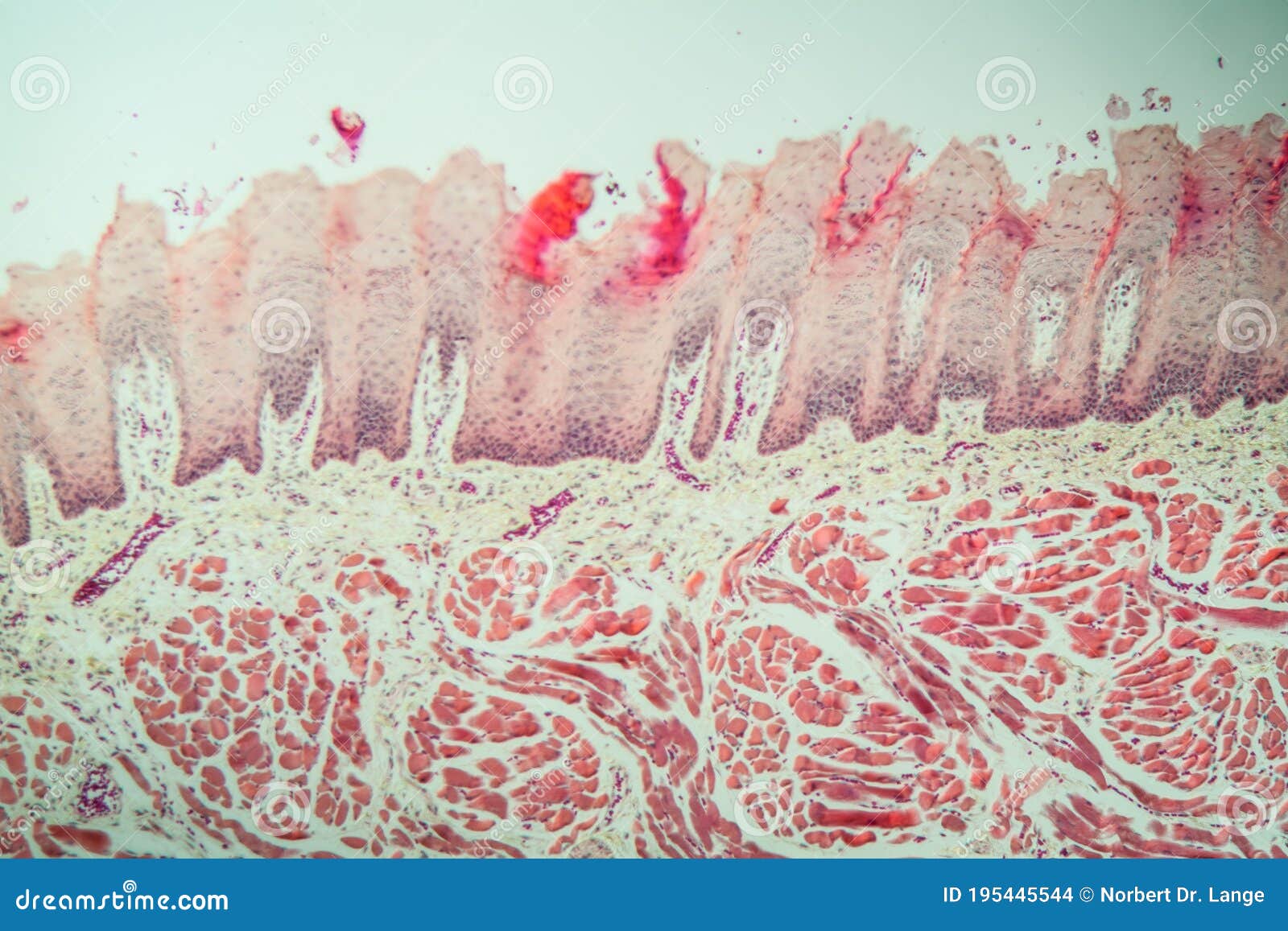 Tongue Tissue with Taste Buds Across Stock Photo - Image of medicine ...