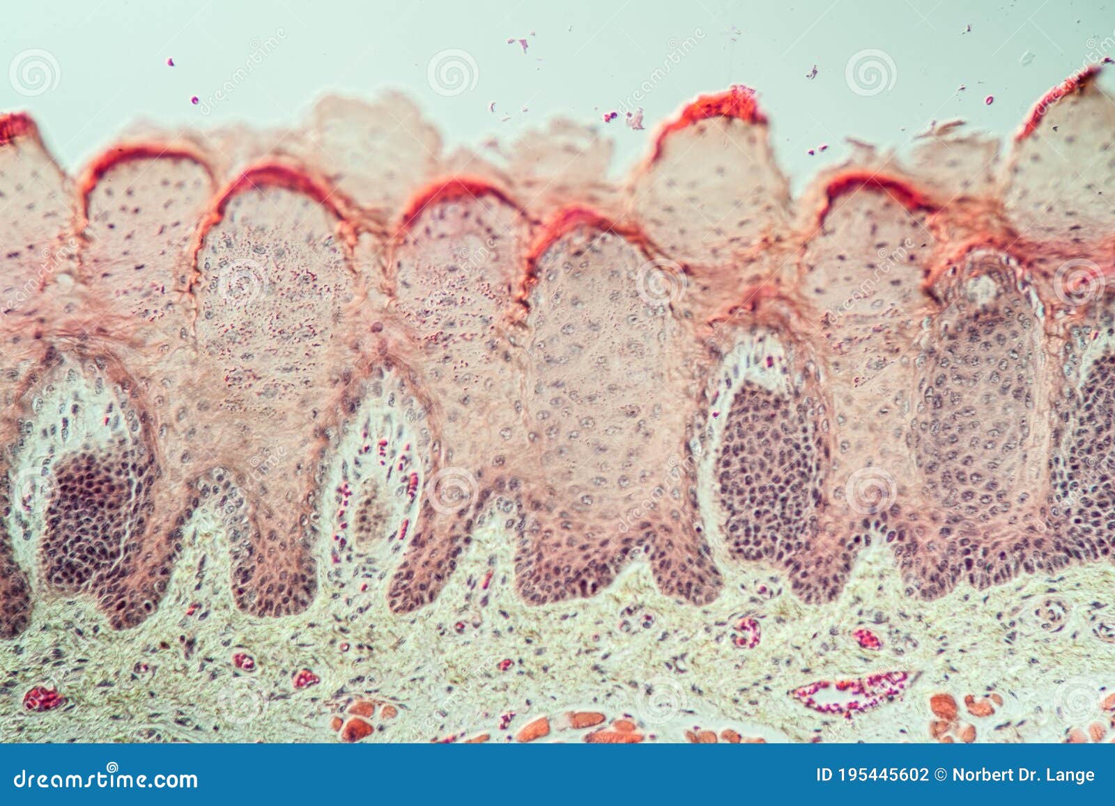 Tongue Tissue with Taste Buds Across Stock Photo - Image of examination ...