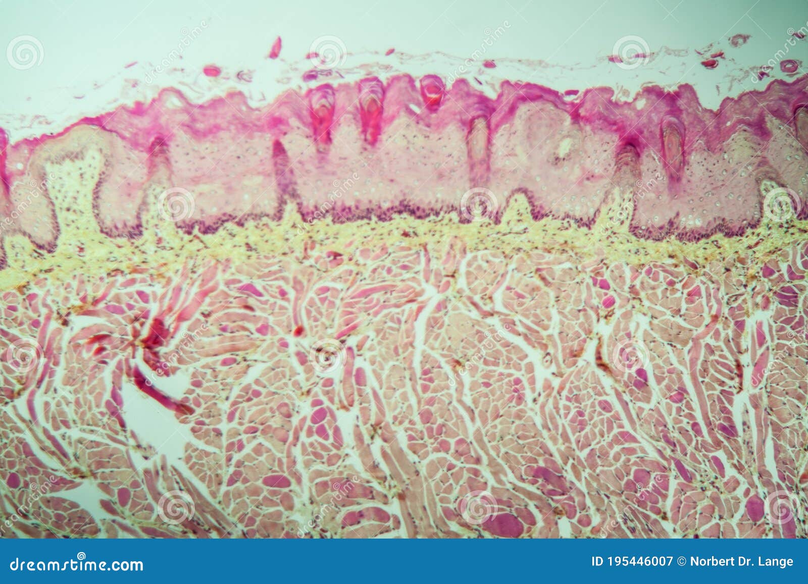 Tongue Tissue with Taste Buds Across Stock Image - Image of small ...