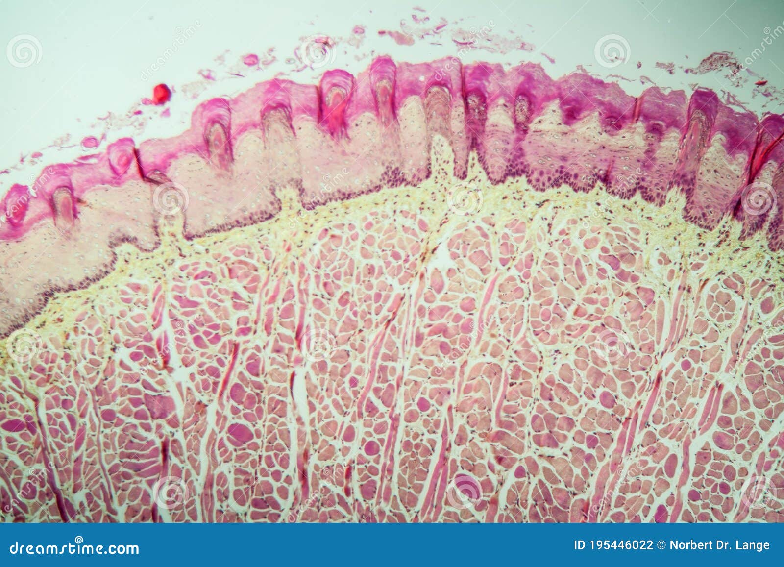 Tongue Tissue with Taste Buds Across Stock Photo - Image of macro ...