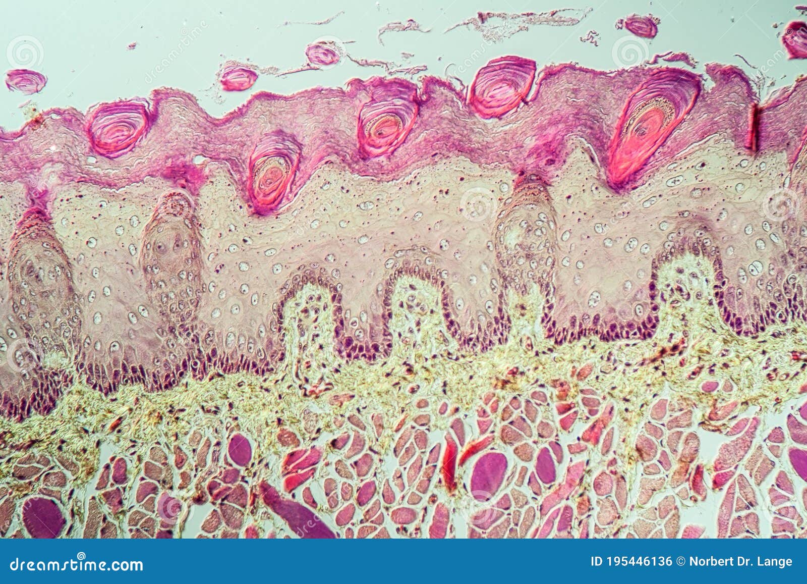 Tongue Tissue with Taste Buds Across Stock Photo - Image of tiny, food ...