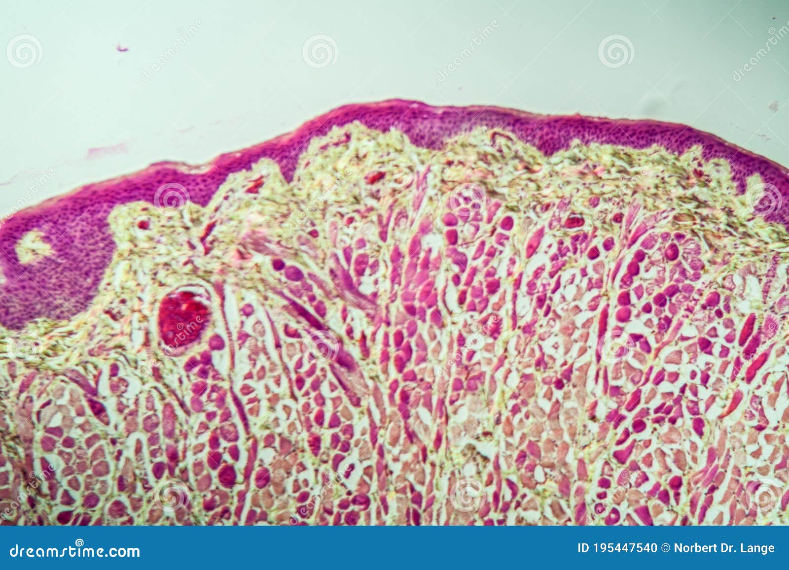 Tongue Tissue with Taste Buds Across Stock Photo - Image of enlargement ...