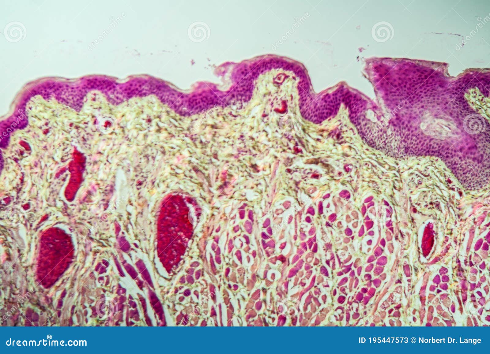 Tongue Tissue with Taste Buds Across Stock Image - Image of tissue ...