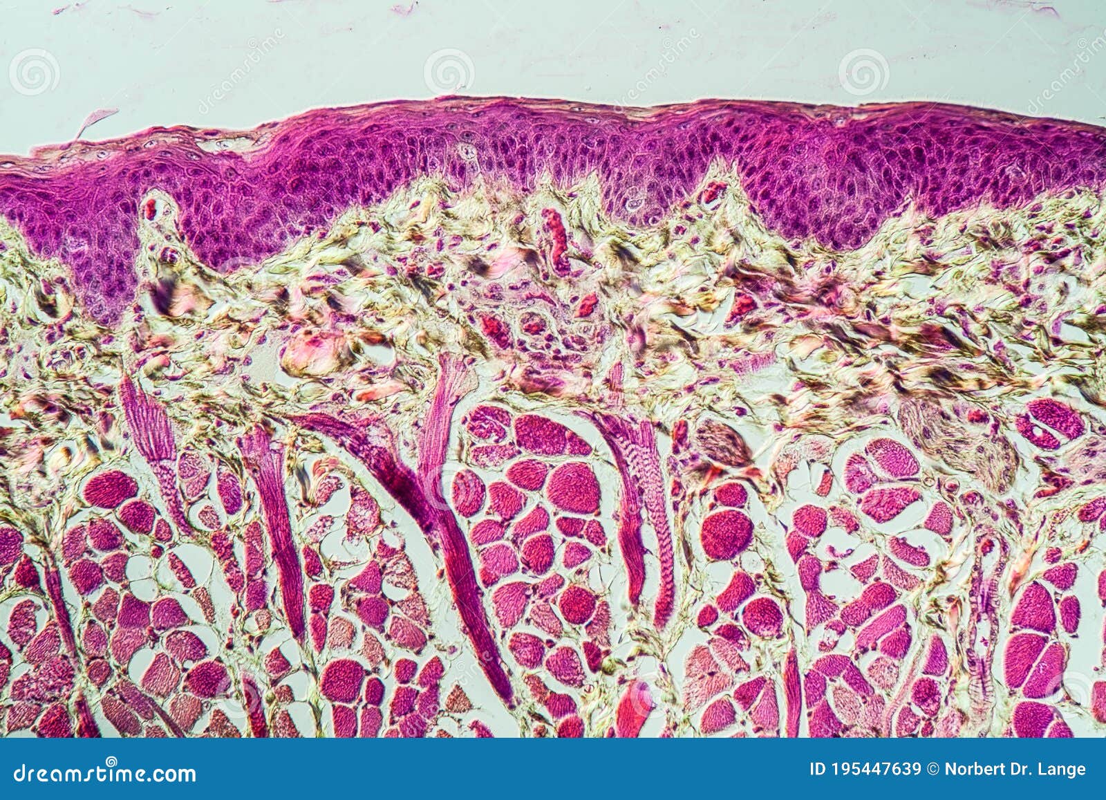Tongue Tissue with Taste Buds Across Stock Image - Image of healing ...