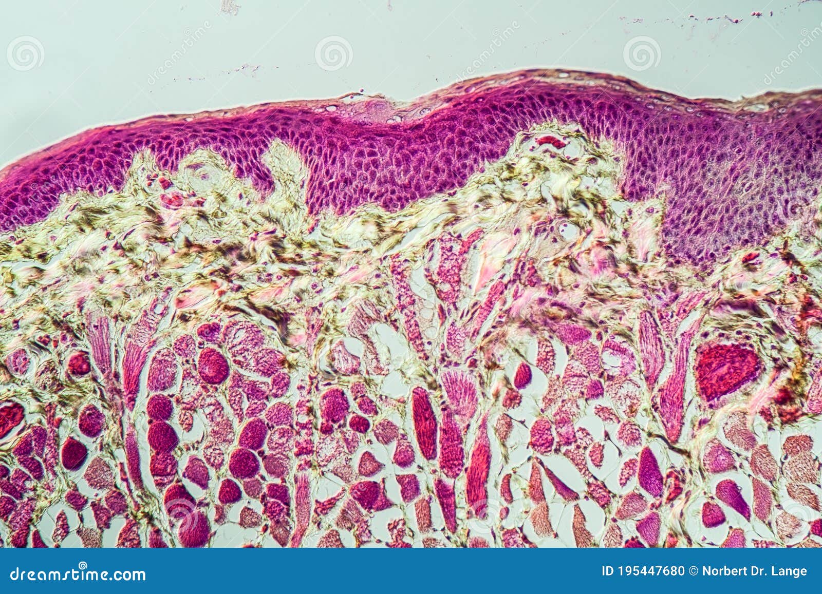 Tongue Tissue with Taste Buds Across Stock Photo - Image of tissue ...
