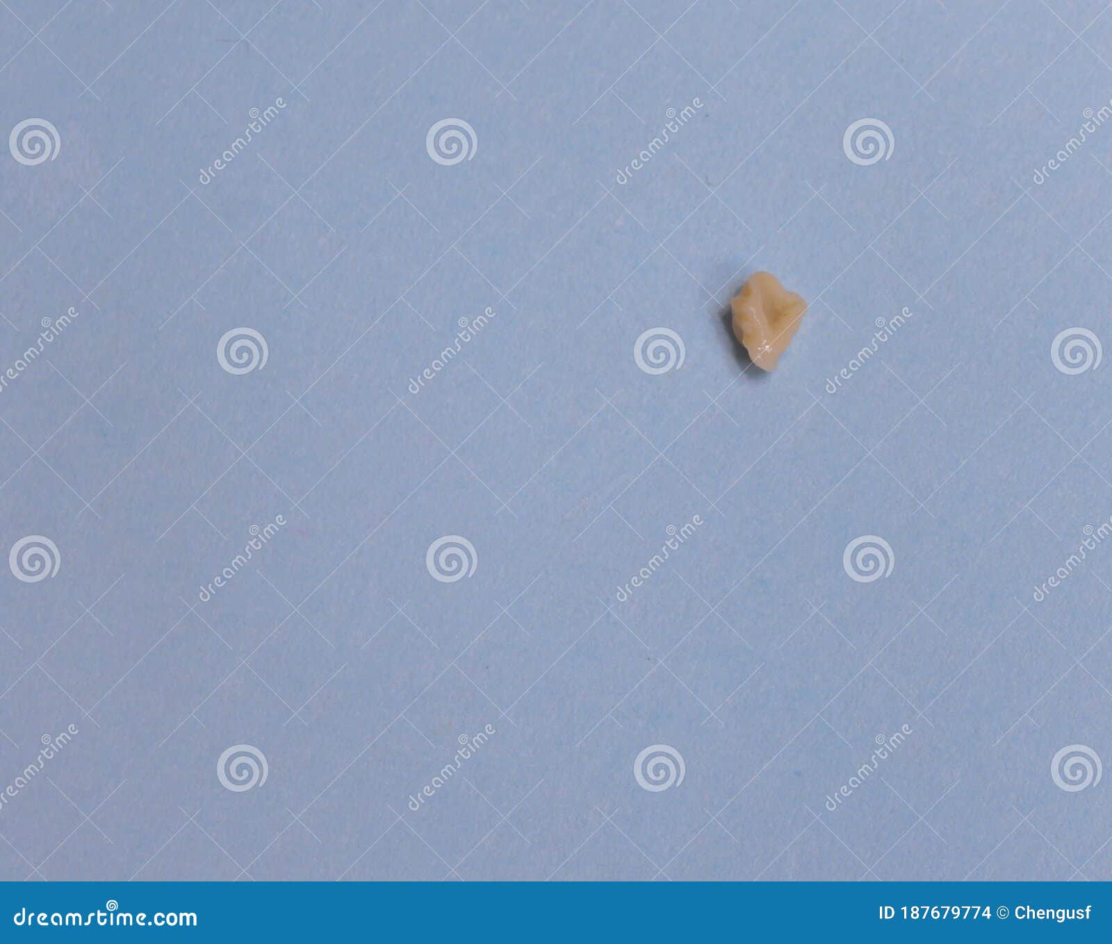 Tonsil stone tonsillolith stock photo. Image of immune - 187679774
