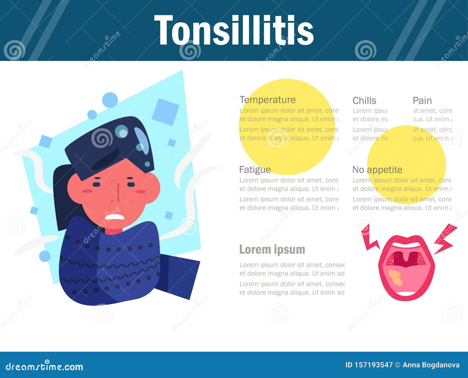 Tonsillitis Vector. Cartoon. Isolated Art On White Background. Flat ...
