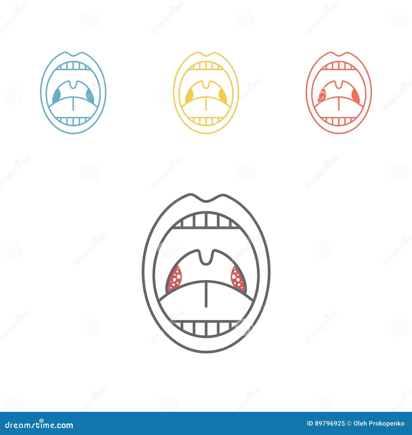 Tonsillitis. Vector sign. stock vector. Illustration of mouth - 89796925