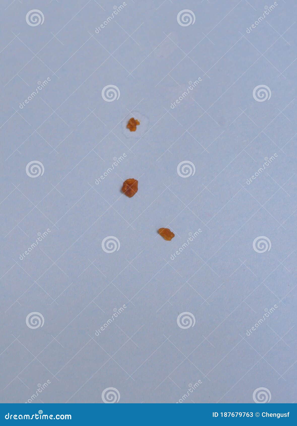 Tonsilloliter, gedroogd stock afbeelding. Image of halitose - 187679763