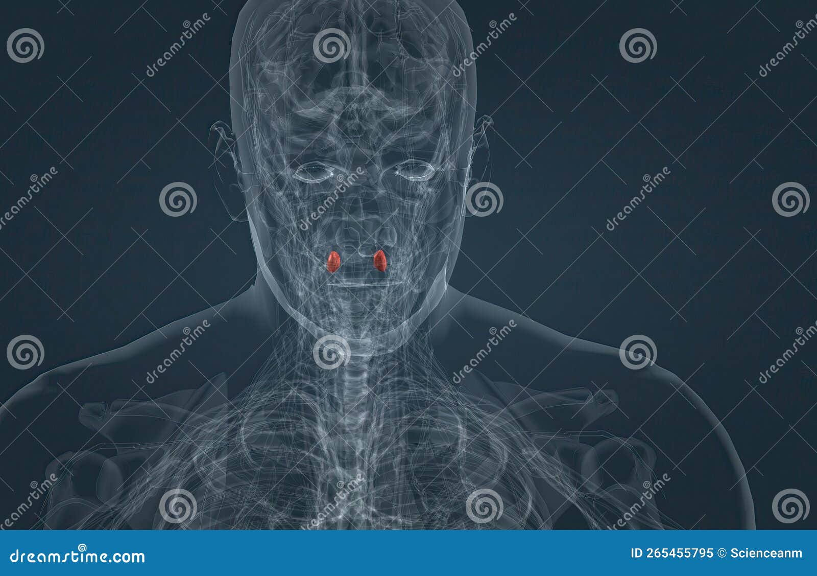 The Tonsils are Collections of Lymphatic Tissue Located within the ...